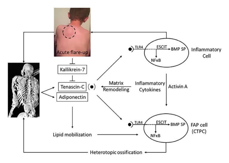 Researchers identify potential FOP biomarkers - FOP